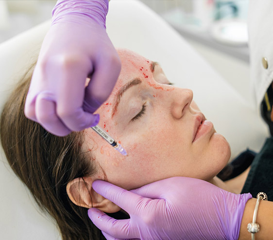 Hydrafacial & Microneedling with DermaPen Mississauga